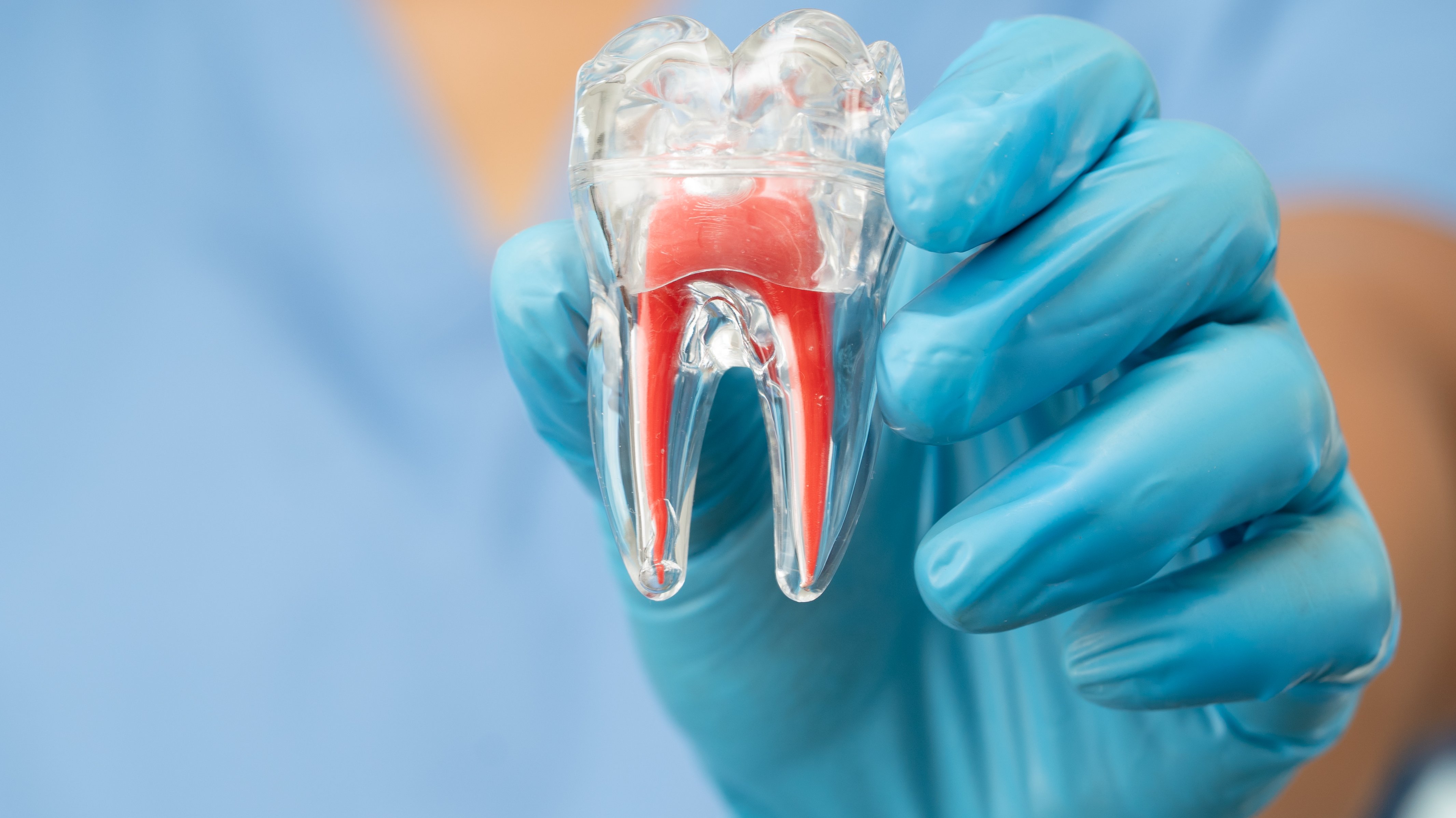 🦷 Wurzelbehandlung – Behandlung, Chancen & Risiken
