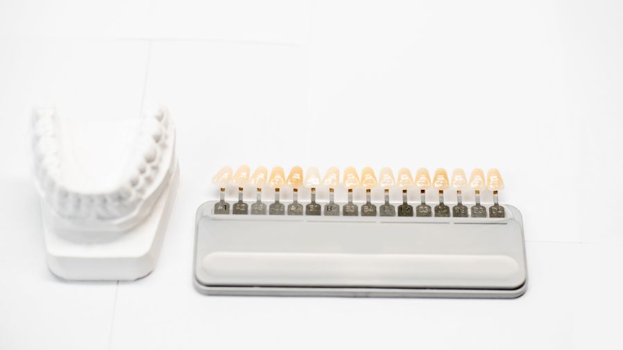 🦷 Warum haben Zähne Nummern? Das Zahnschema erklärt