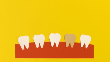 🦷 GOZ 3010: Entfernung eines mehrwurzeligen Zahnes